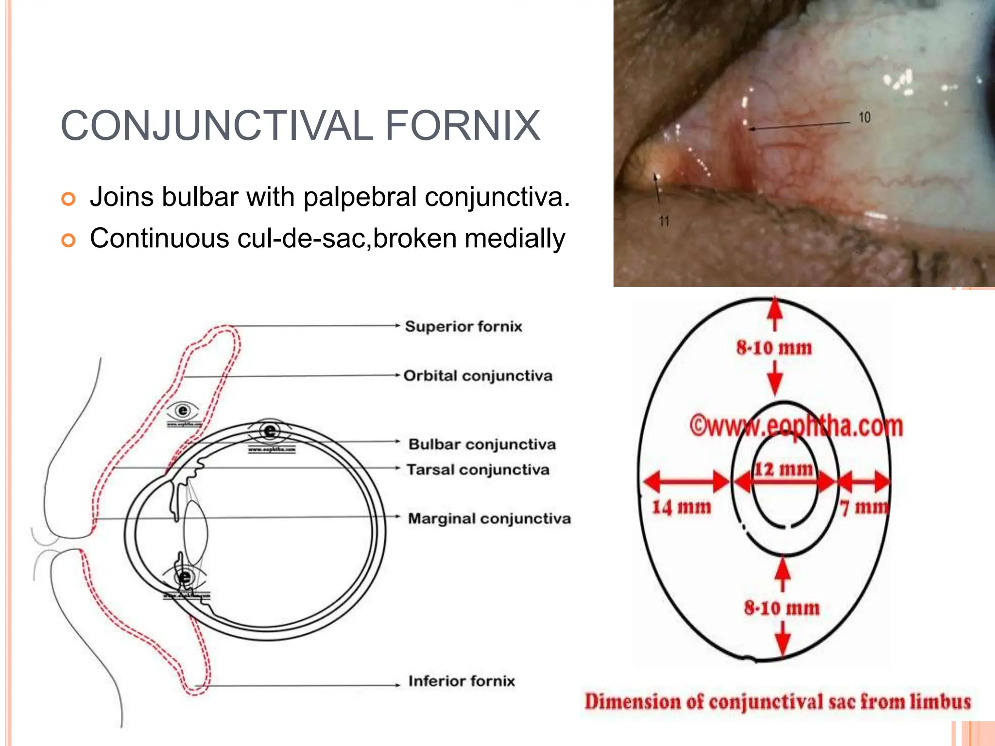 anatomy and pathophysiology of conjunctiva.pptx