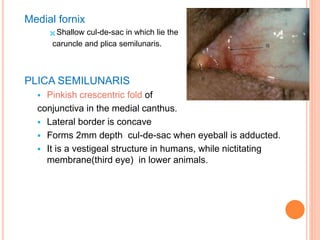 anatomy and pathophysiology of conjunctiva.pptx