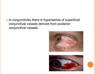 anatomy and pathophysiology of conjunctiva.pptx