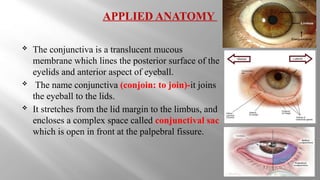 Anatomy of Conjunctiva, types, layers pptx | PPTX