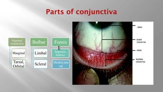 Anatomy of Conjunctiva, types, layers pptx | PPTX