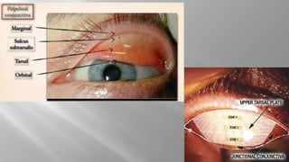 Anatomy of Conjunctiva, types, layers pptx | PPTX