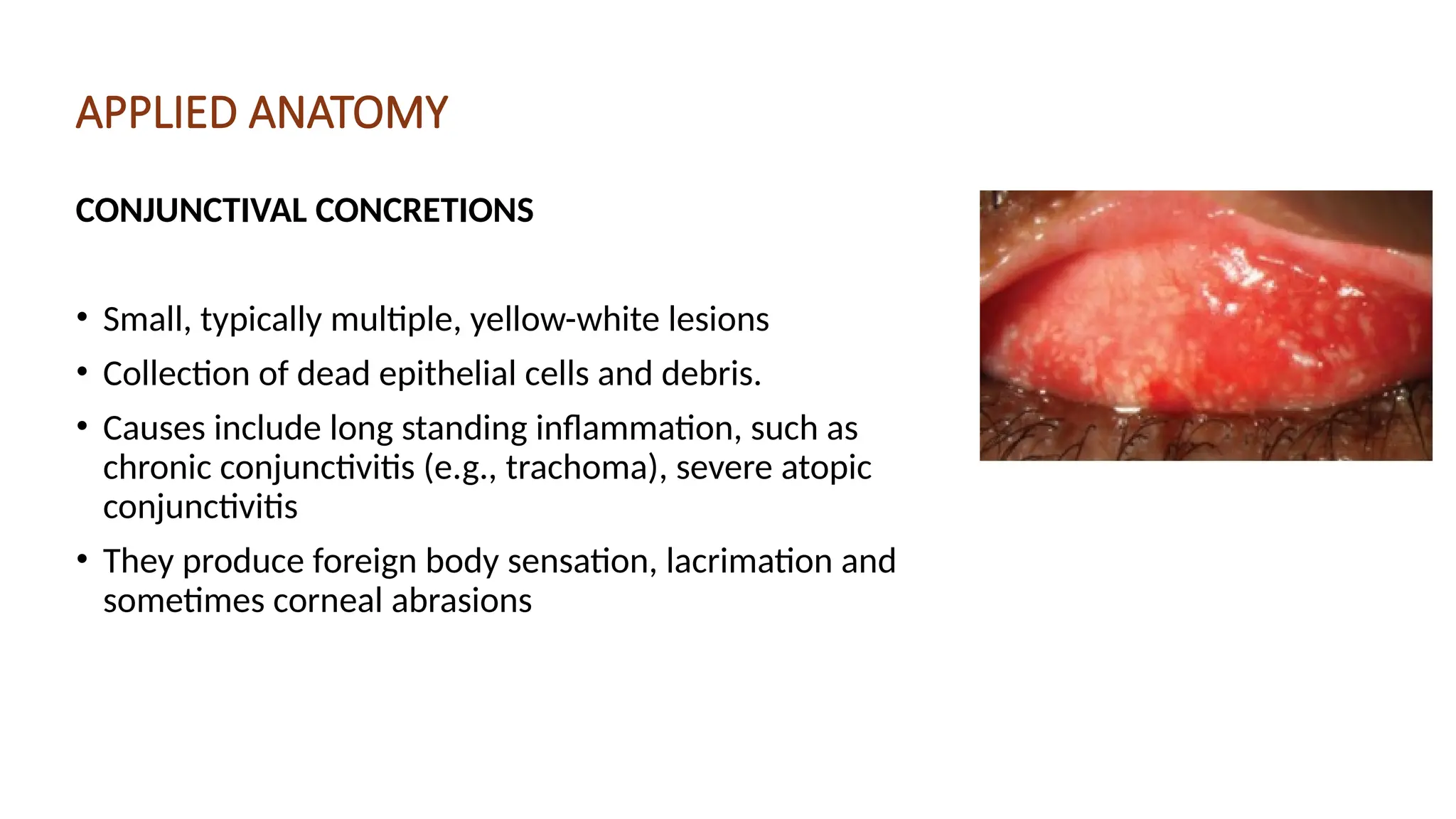 anatomy of conjunctiva and sclera- Dr Sanjana.pptx