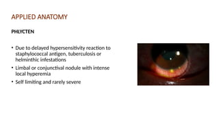 anatomy of conjunctiva and sclera- Dr Sanjana.pptx