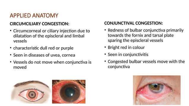 anatomy of conjunctiva and sclera- Dr Sanjana.pptx