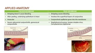 anatomy of conjunctiva and sclera- Dr Sanjana.pptx