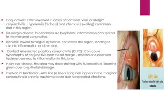 Anatomy of conjunctiva and clinical .pptx