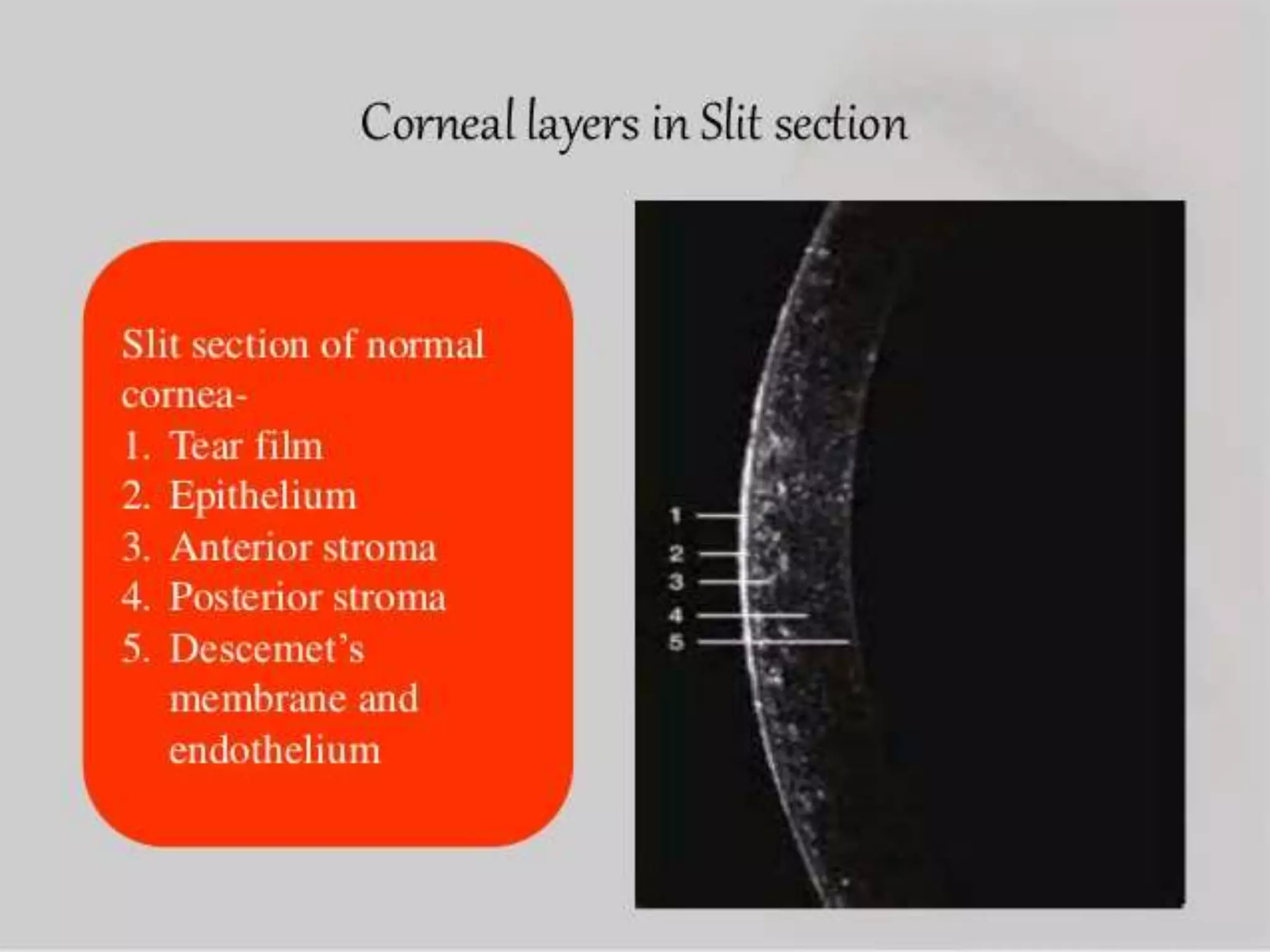 Anatomy of cornea | PPT