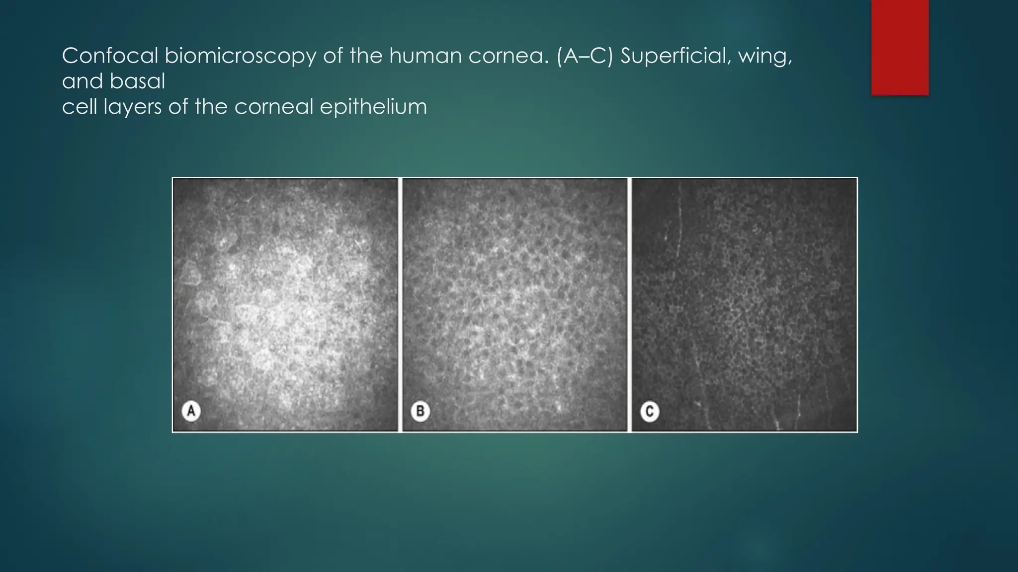 anatomy of cornea powerpoint presentatation .pptx