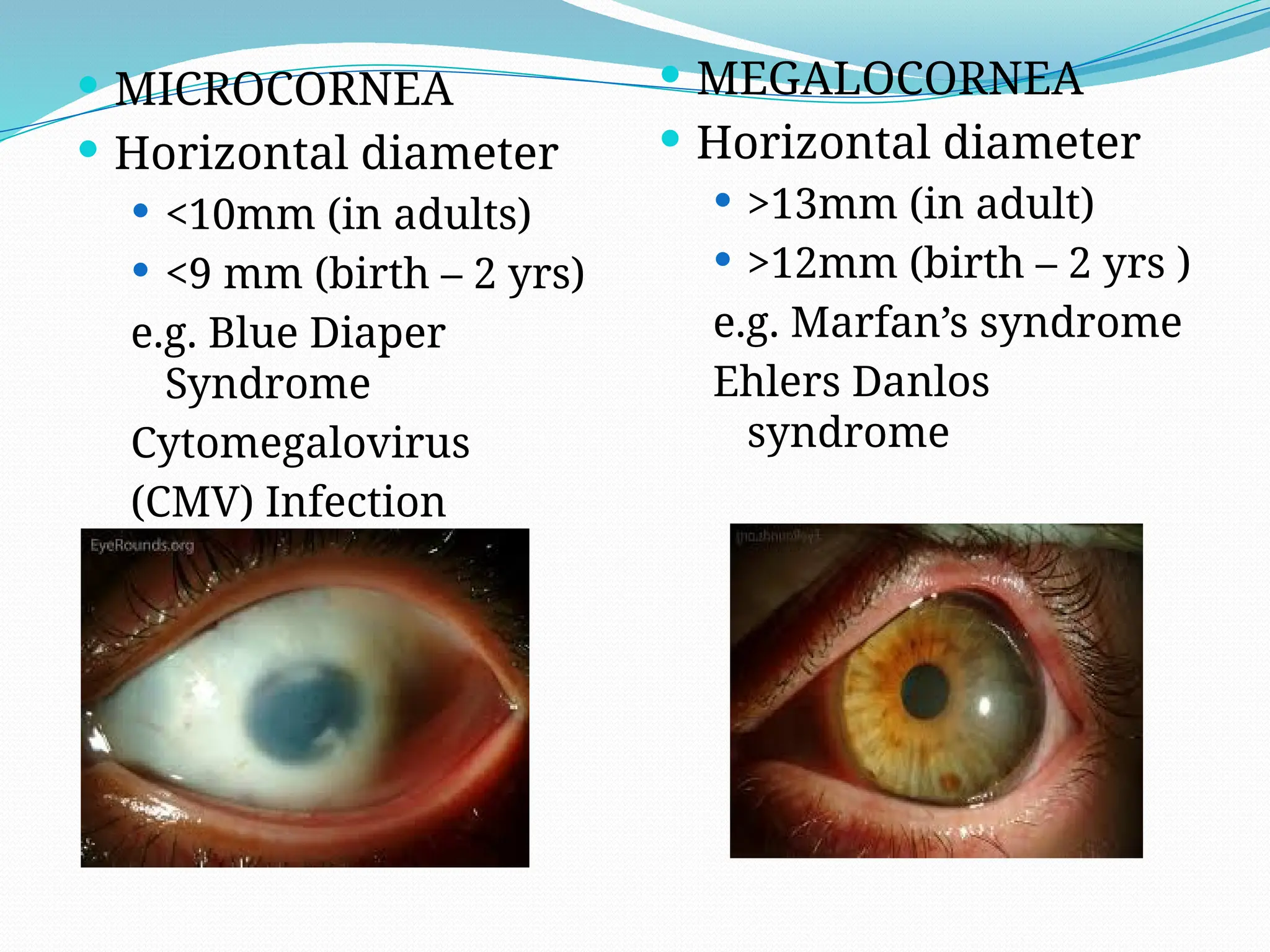 ANATOMY OF CORNEA.pptx anatomy of cornea | PPTX