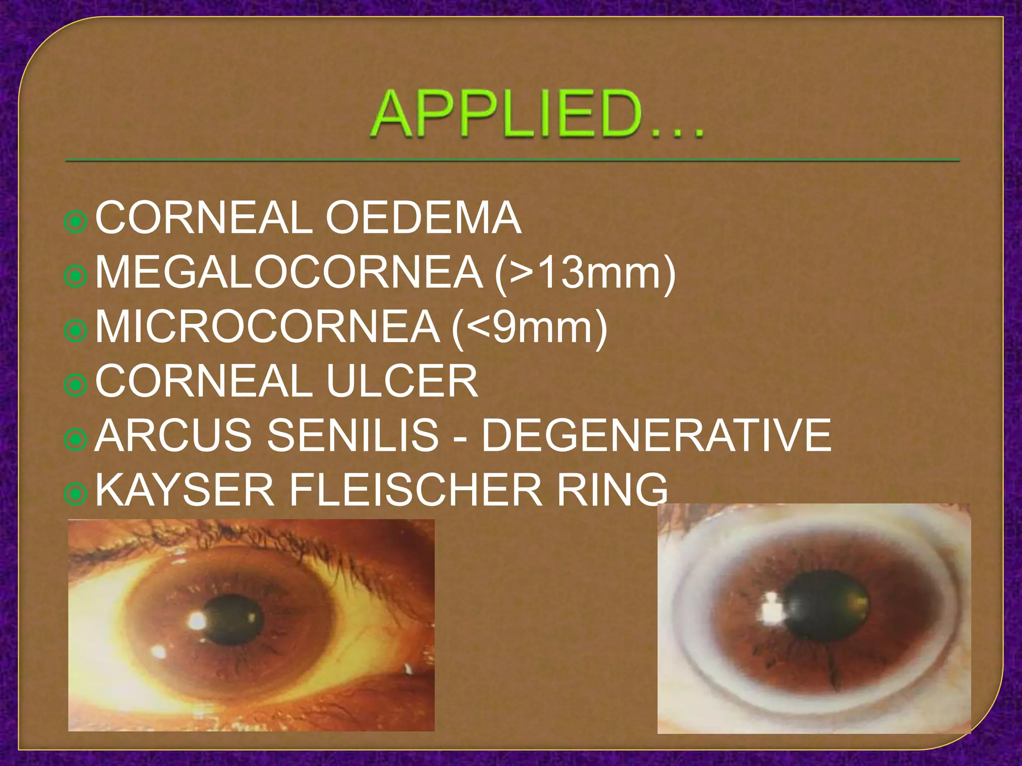 Anatomy of cornea copy | PPT