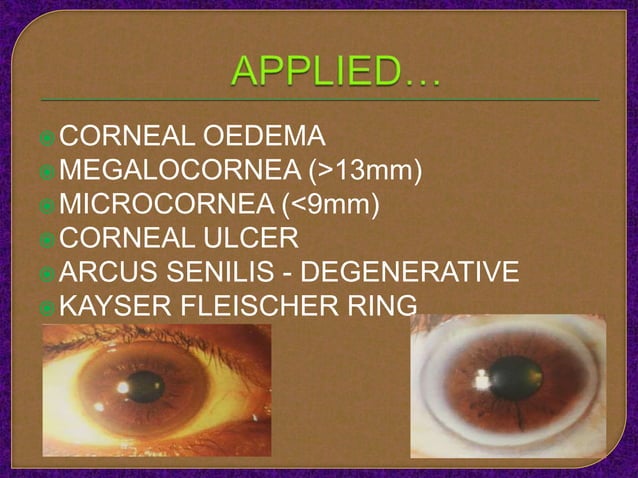 Anatomy of cornea copy | PPT