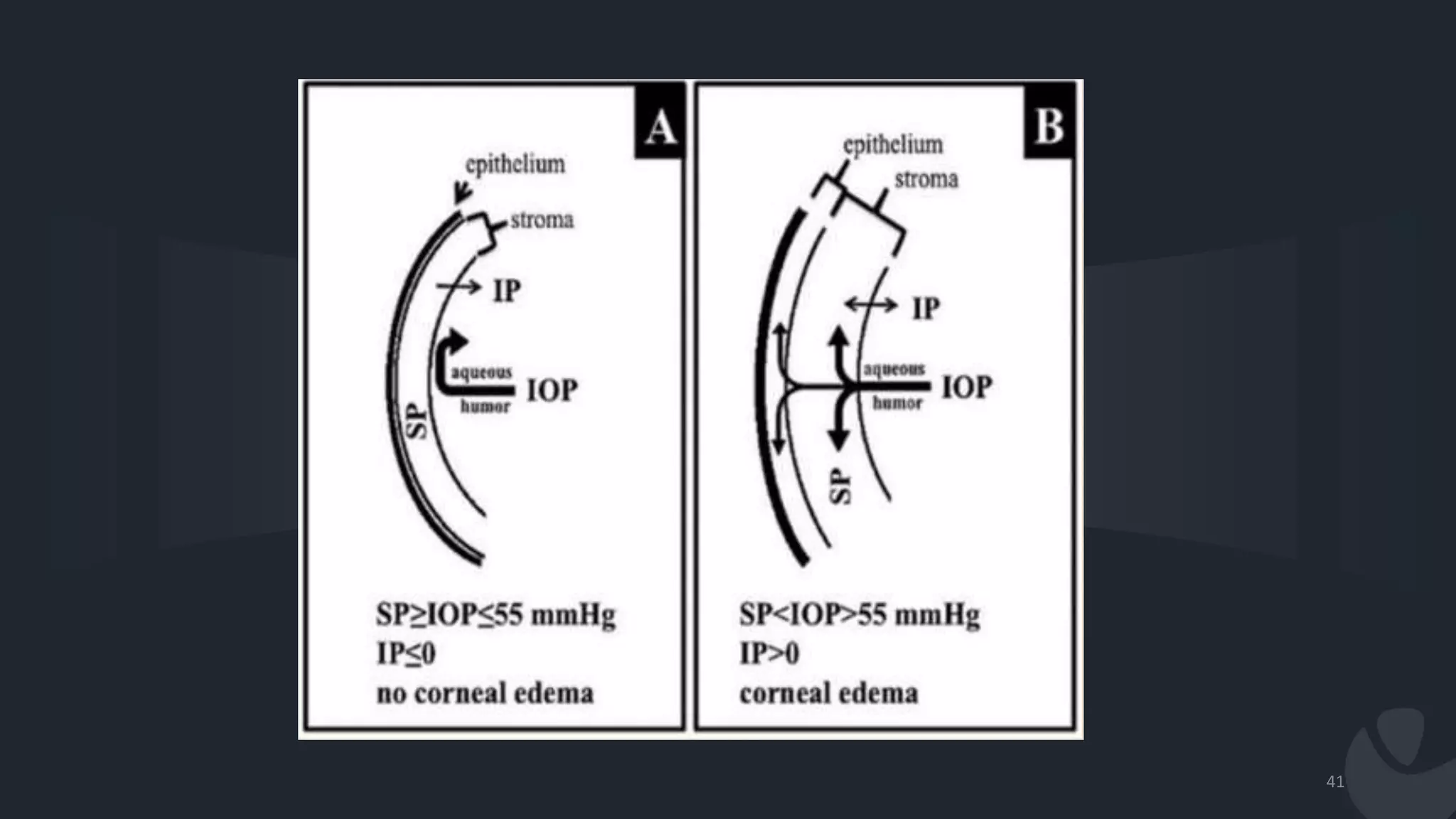 Anatomy Of Cornea And Sclera Pptx