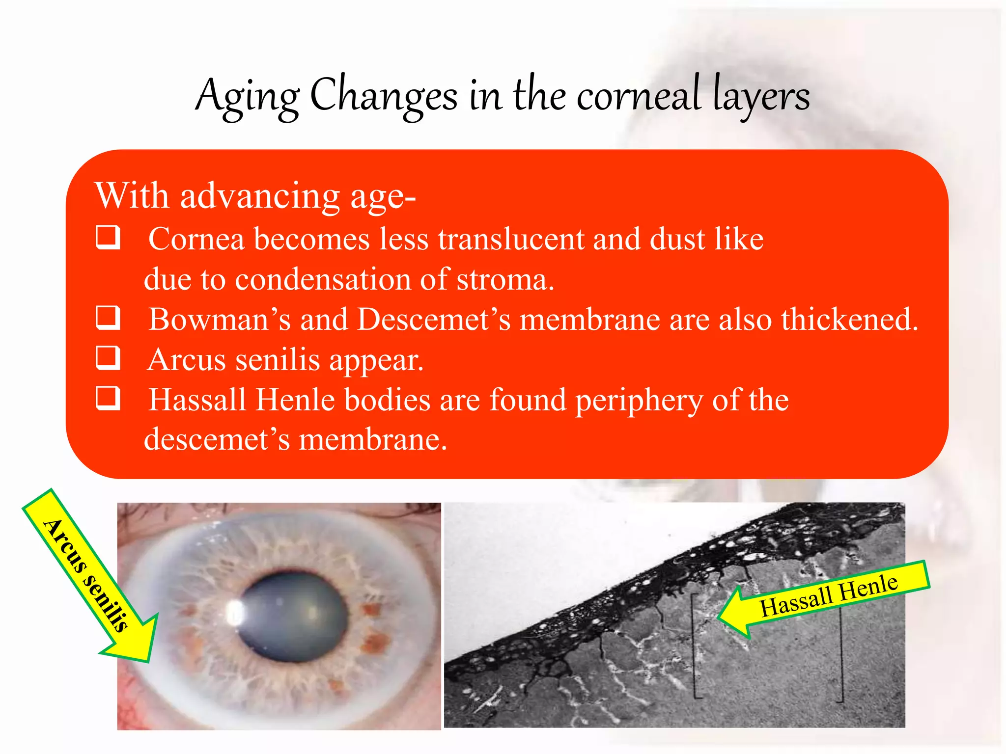 Anatomy of cornea of dr. sohel mahmud | PPTX