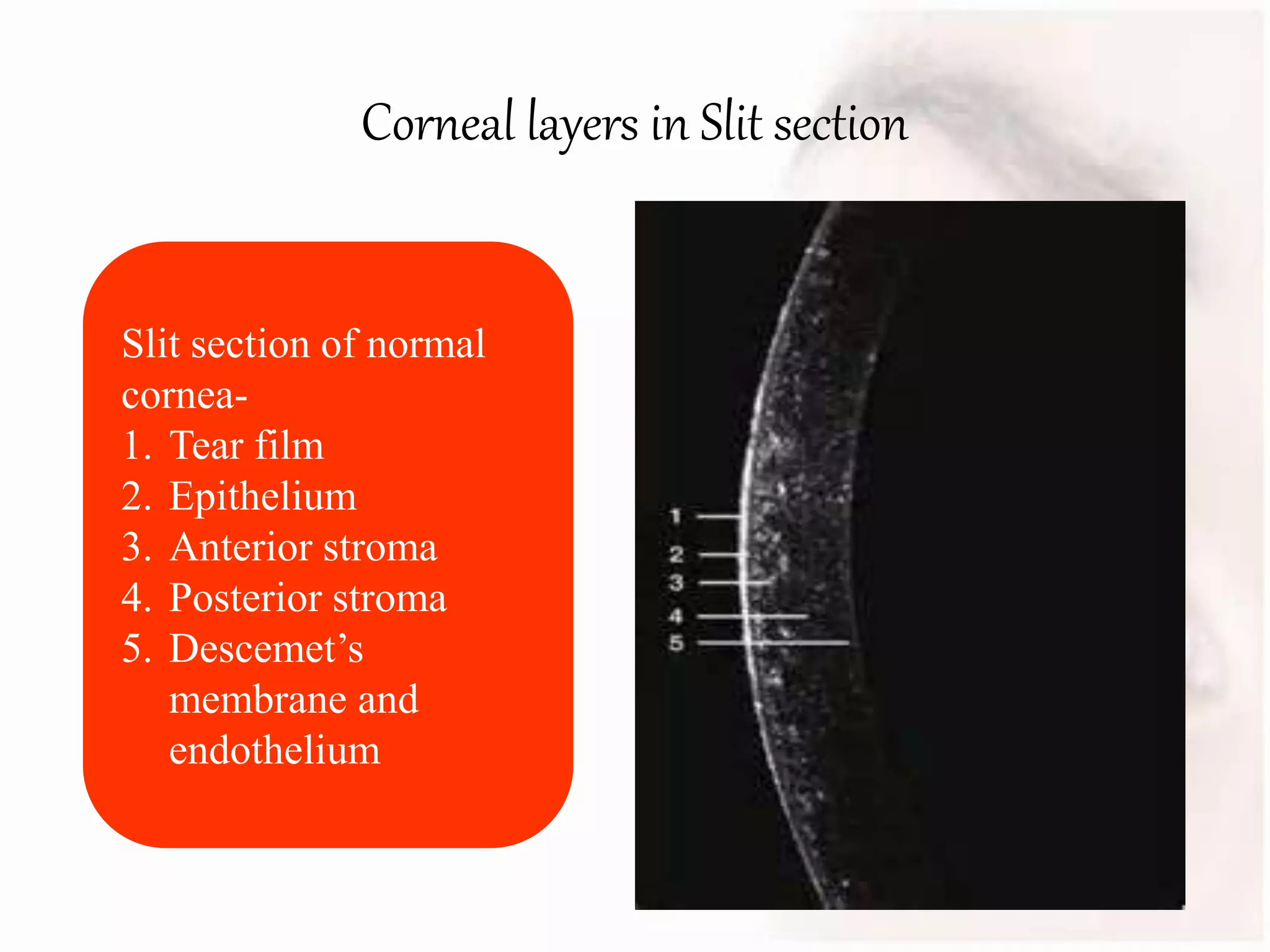 Anatomy of cornea of dr. sohel mahmud | PPTX
