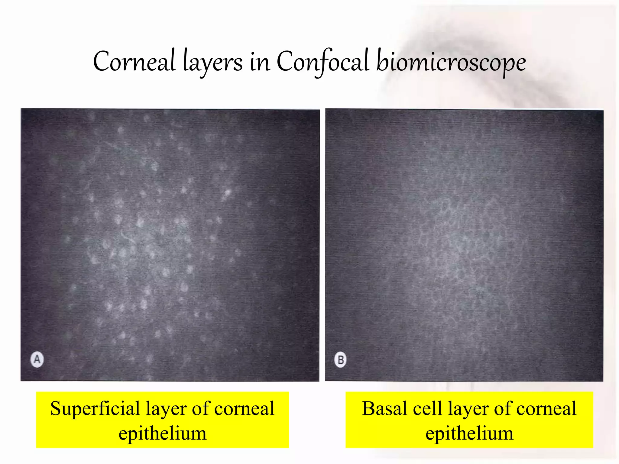 Anatomy of cornea of dr. sohel mahmud | PPTX