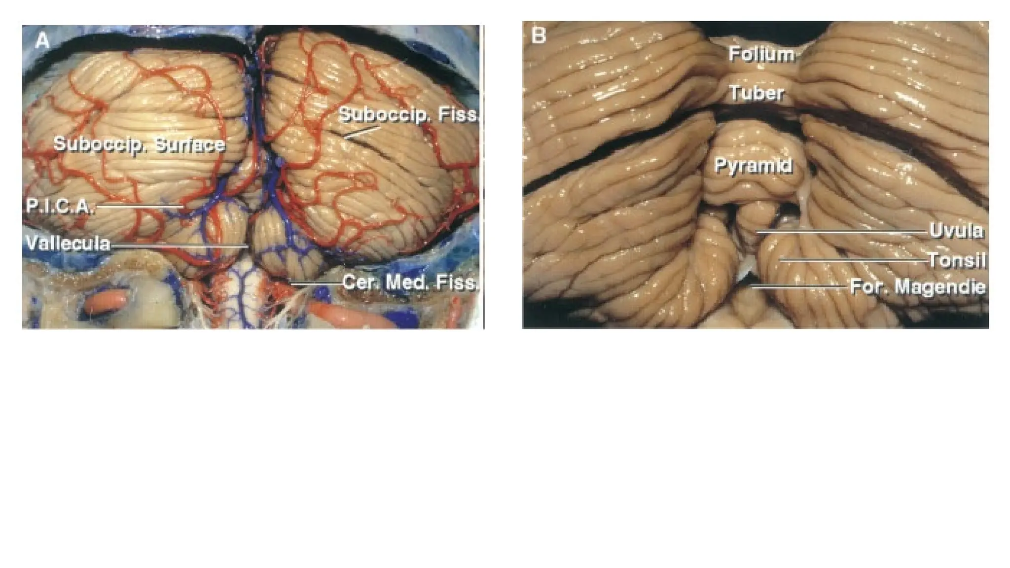 Anatomy of Cortex of CEREBELLUM with hand made lines.pdf | Brain and ...