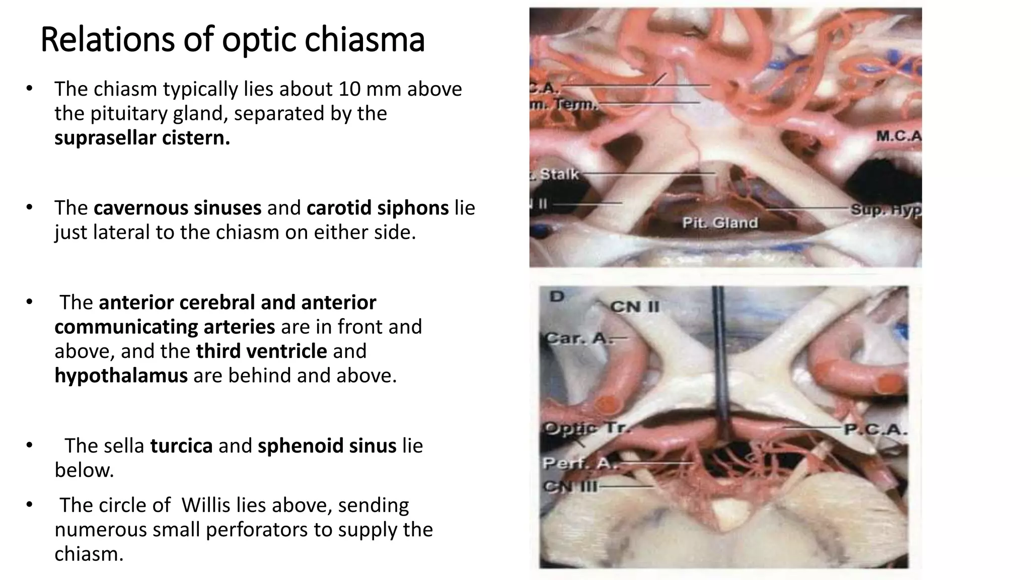 Anatomy of Olfactory nerve, Optic Nerve, Trigeminal Nerve | PPTX