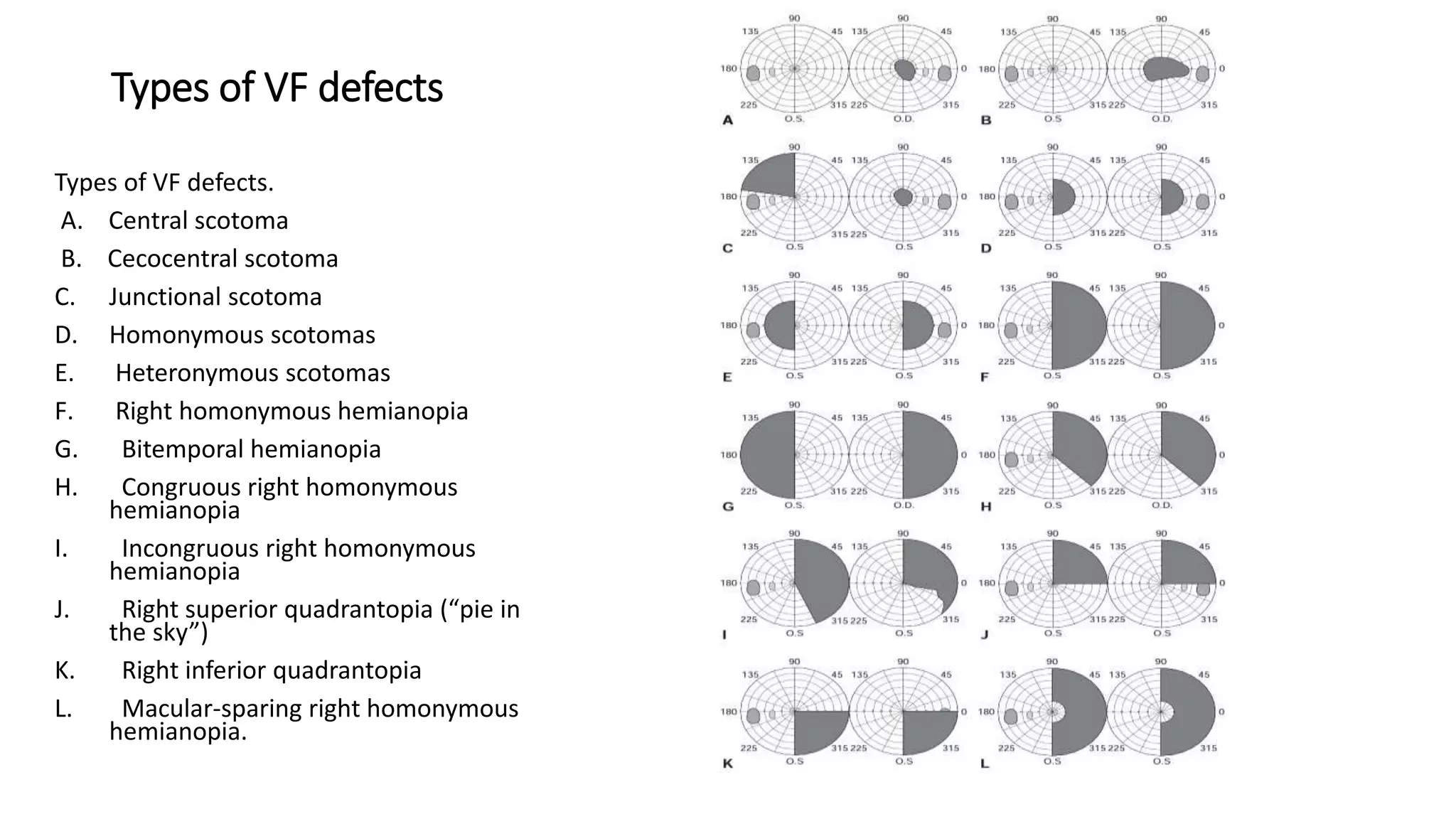 Anatomy of Olfactory nerve, Optic Nerve, Trigeminal Nerve | PPTX