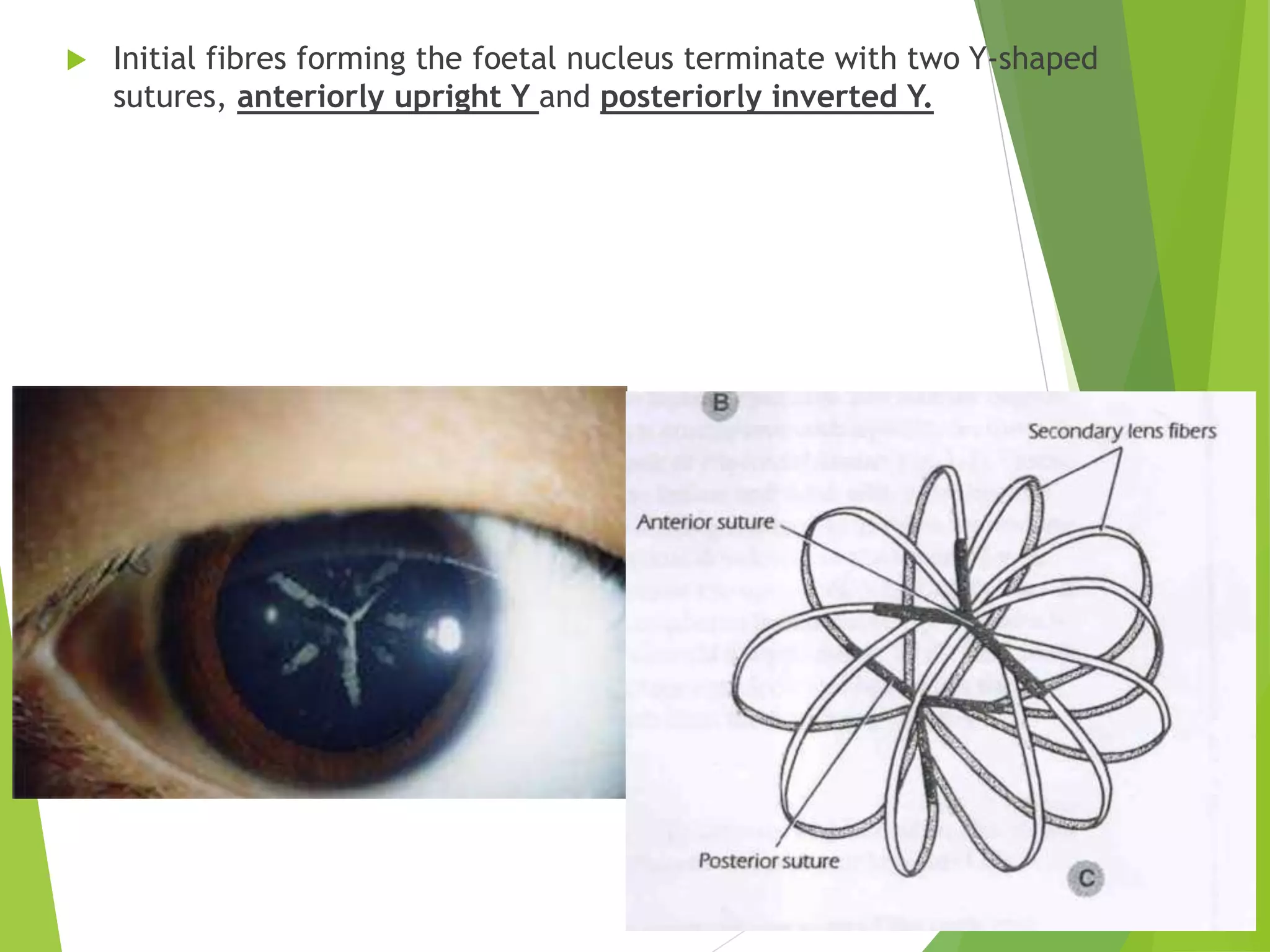 Anatomy of crystalline lens by Dr. Aayush Tandon | PPTX