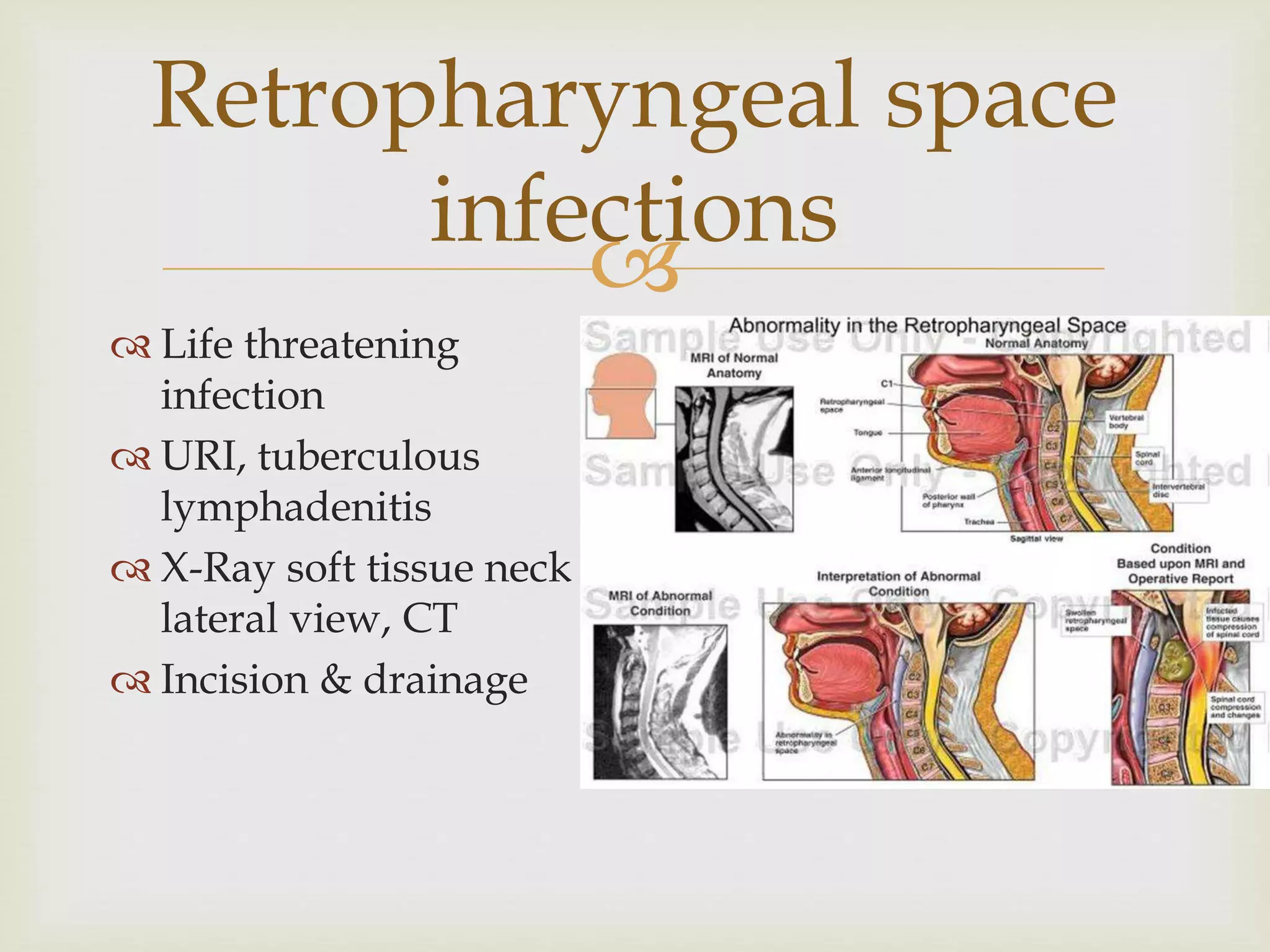 SURGICAL ANATOMY OF DEEP NECK SPACES | PPTX