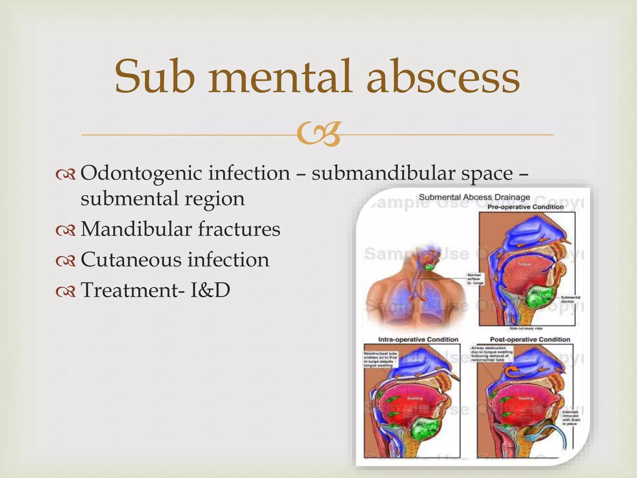 SURGICAL ANATOMY OF DEEP NECK SPACES | PPTX