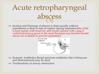 Retropharyngeal Abscess Anatomy