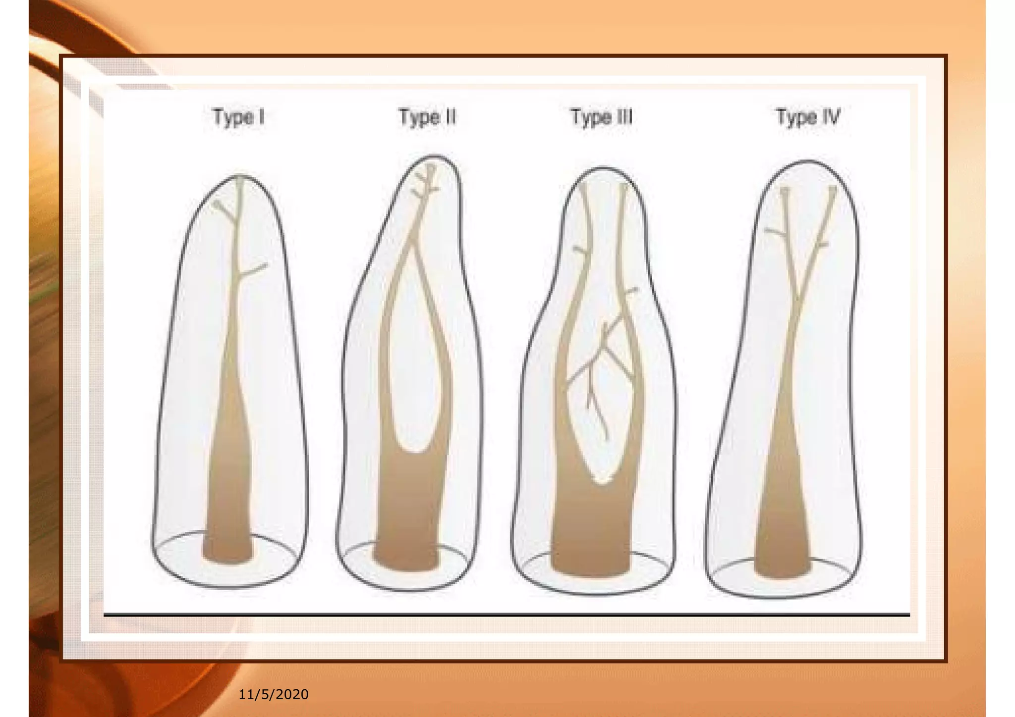 Anatomy of dental pulp.pdf | Dental Health | Diseases and Conditions