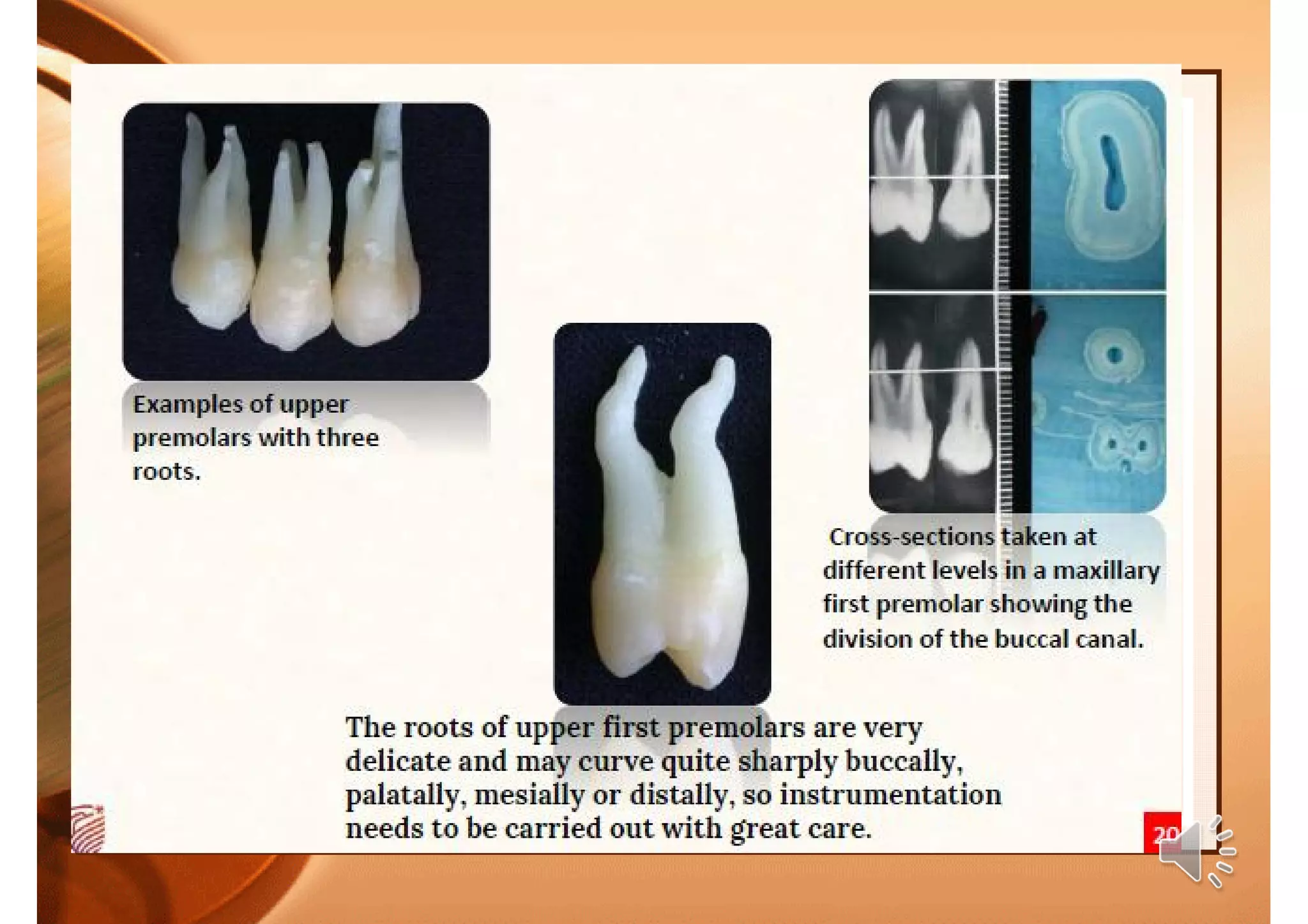 Anatomy of dental pulp.pdf | Dental Health | Diseases and Conditions