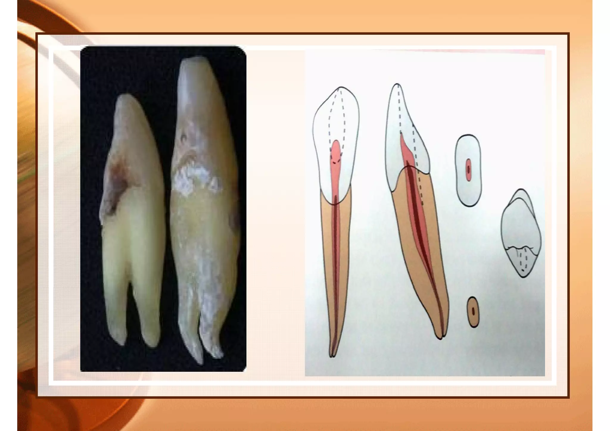 Anatomy of dental pulp.pdf