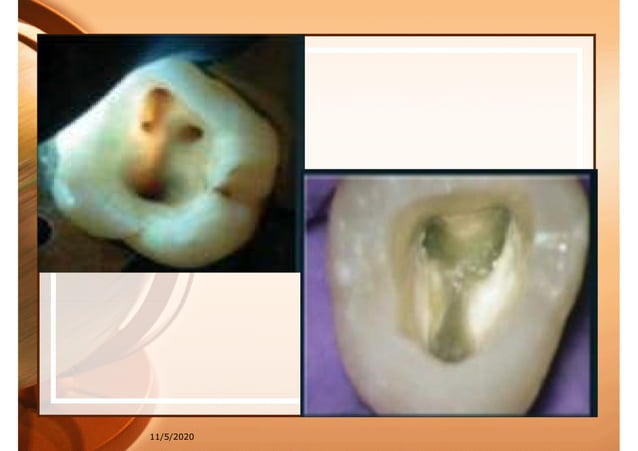 Anatomy of dental pulp.pdf | Dental Health | Diseases and Conditions