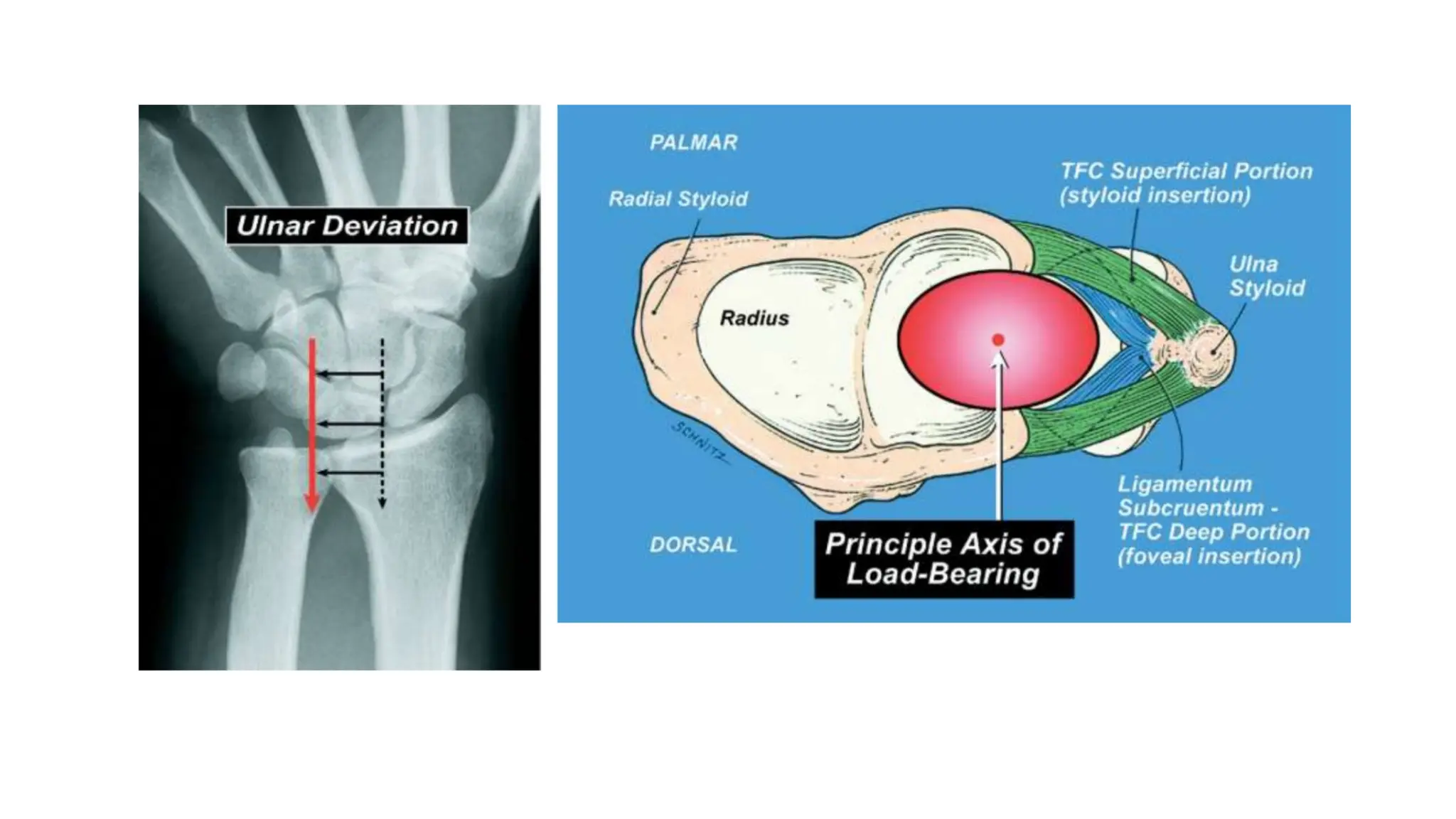 Anatomy of distal radioulnar joint and its function | PPTX