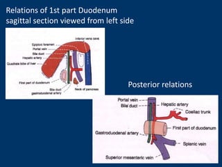 Anatomy of duodenum, duodenum structure, PPT of duodenum, power point ...