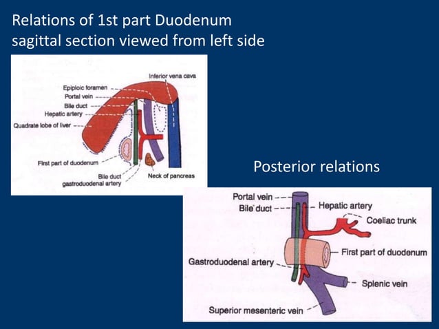 Anatomy of duodenum, duodenum structure, PPT of duodenum, power point presentation duodenum ...