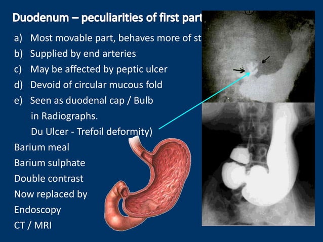 Anatomy of duodenum, duodenum structure, PPT of duodenum, power point presentation duodenum ...