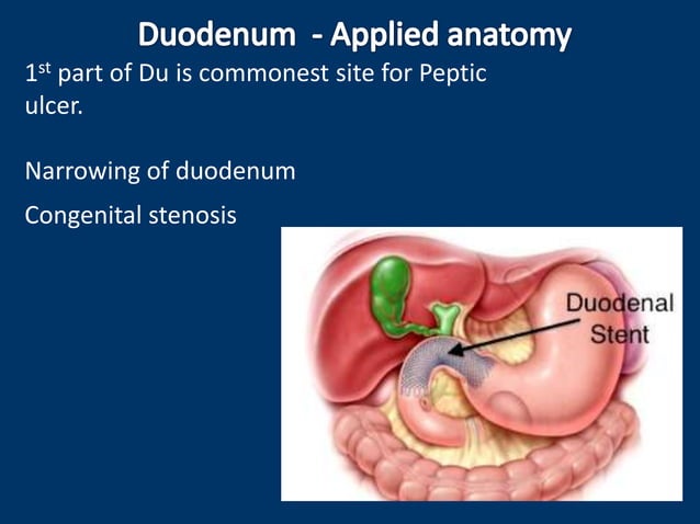 Anatomy of duodenum, duodenum structure, PPT of duodenum, power point presentation duodenum ...