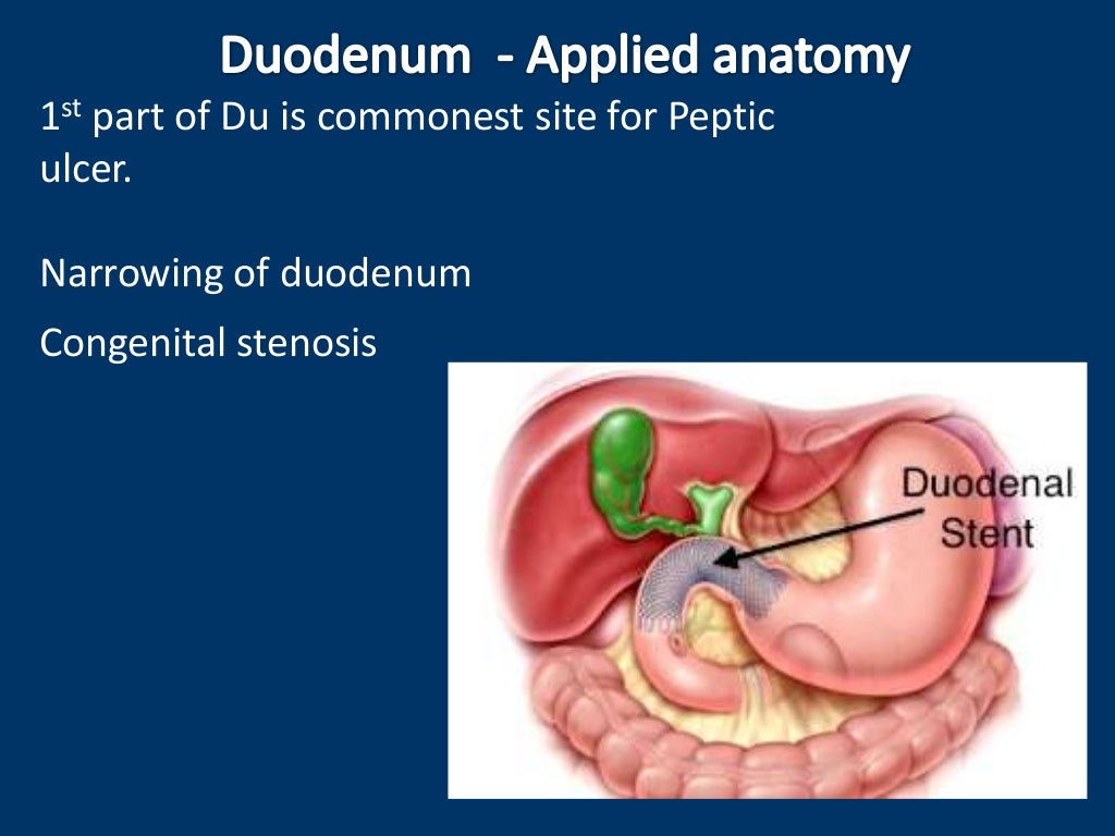 Anatomy Of Duodenum Duodenum Structure Ppt Of Duodenum Power Point…