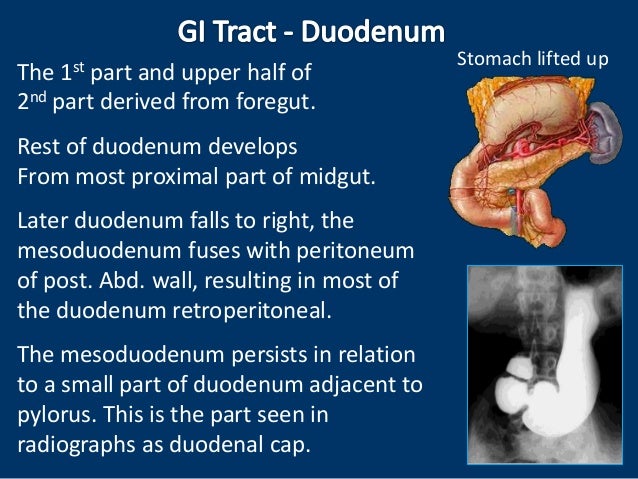 Anatomy Of Duodenum Duodenum Structure Ppt Of Duodenum Power Point…
