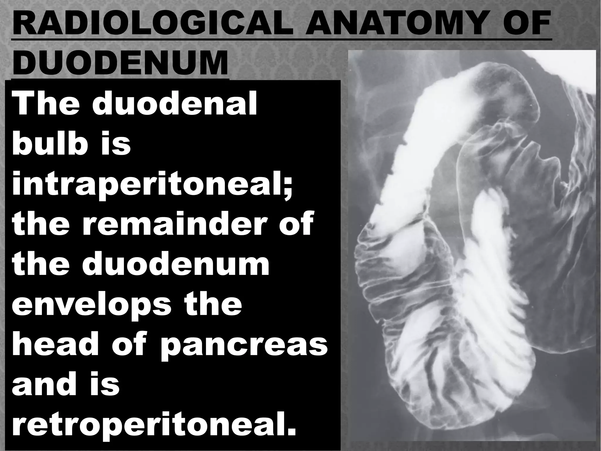 Anatomy of duodenum | PPTX