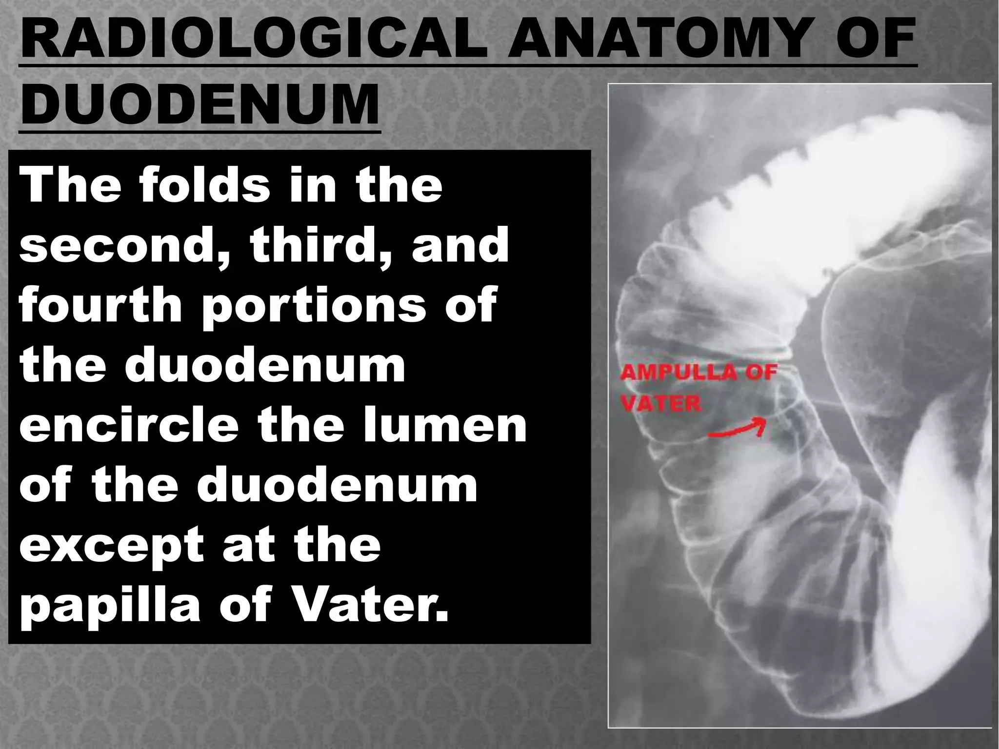 Anatomy of duodenum | PPTX