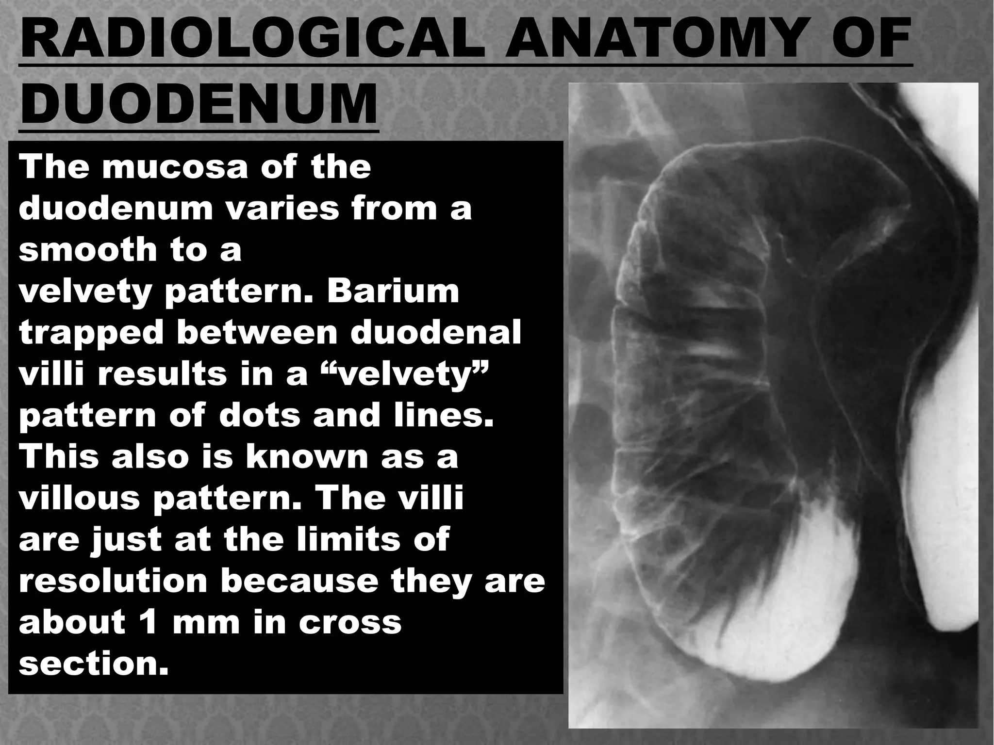 Anatomy of duodenum | PPTX