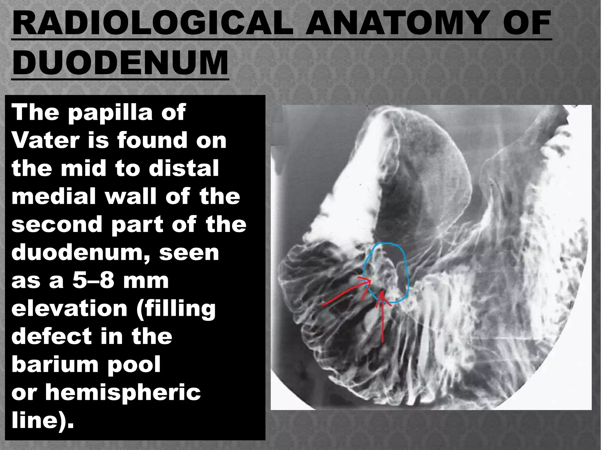 Anatomy of duodenum | PPTX