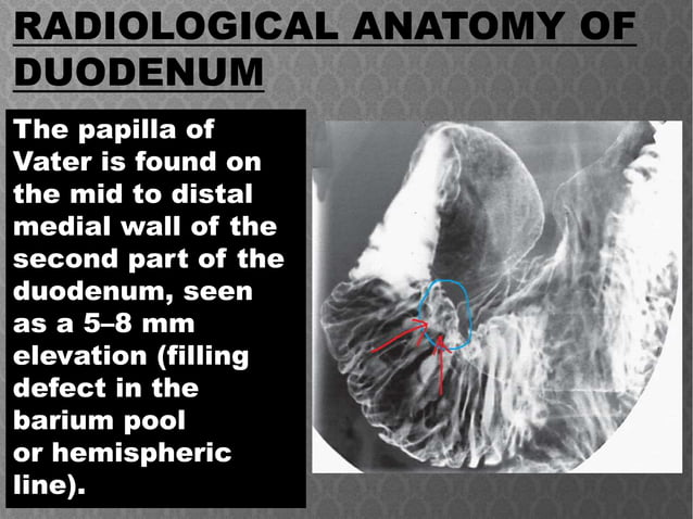 Anatomy of duodenum | PPT