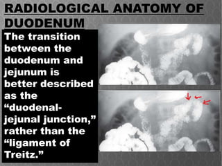 Anatomy of duodenum | PPTX