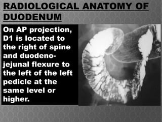 Anatomy of duodenum | PPTX