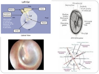 Otoscope View Anatomy