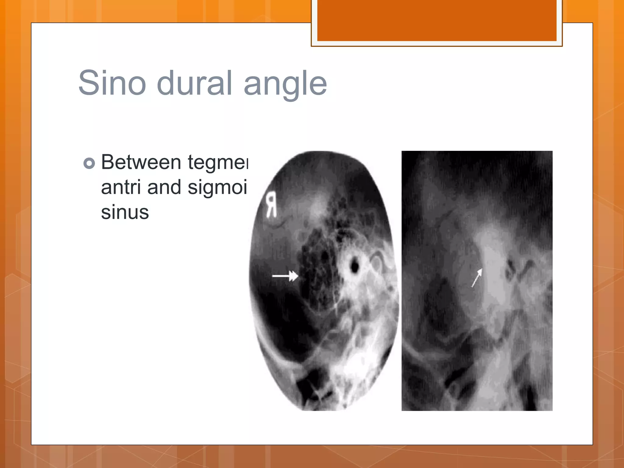 Anatomy of ear | PPTX