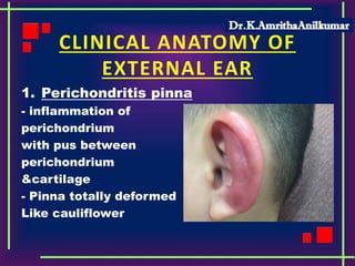 Anatomy of ear by Dr.K.AmrithaAnilkumar | PPTX
