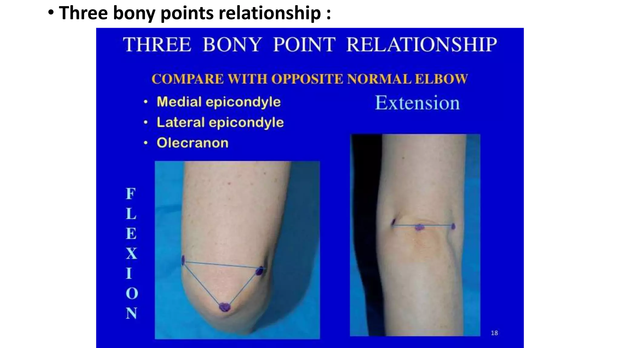 Anatomy of elbow and INTERCONDYLAR FRACTURE OF THE HUMERUS | PPTX