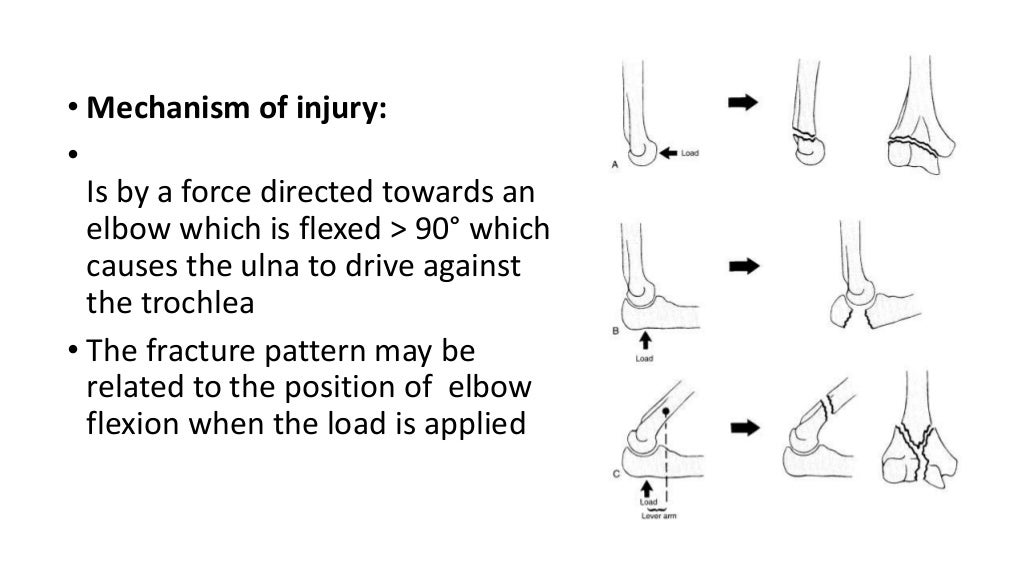 Anatomy of elbow and INTERCONDYLAR FRACTURE OF THE HUMERUS